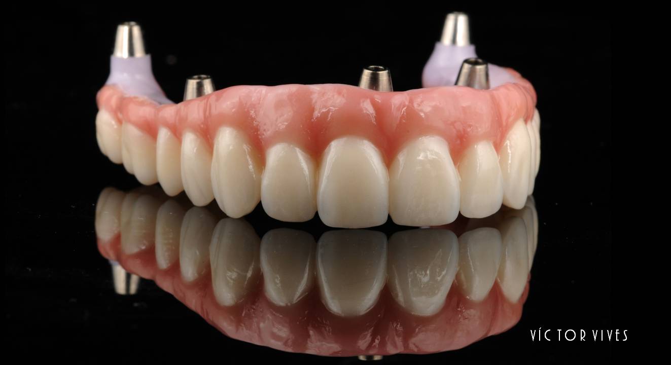 Víctor Vives: ZIRKONZAHN PRETTAU CAD CAM