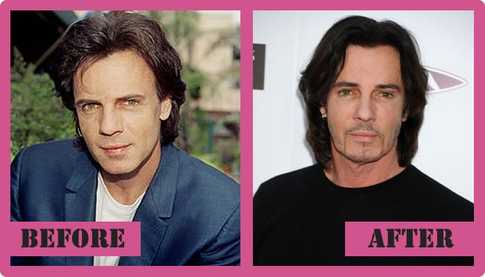 Rick Springfield Plastic Surgery Blog: Rick Springfield Plastic Surgery ...