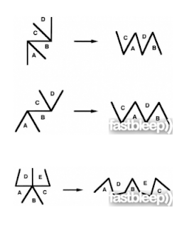 Skin Contracture and Z-plasty Correction | Congenital Hand and Arm ...