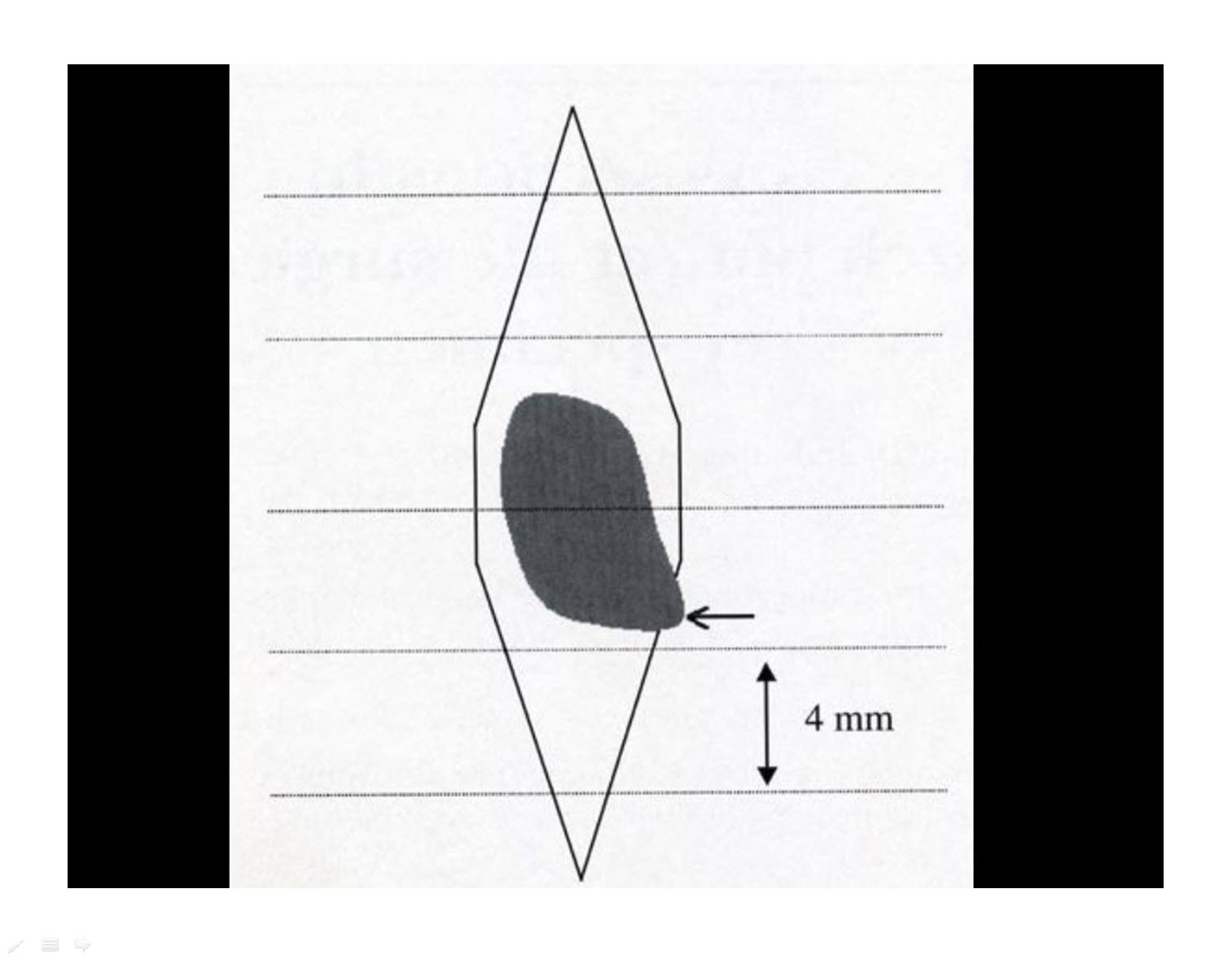 Dermatopathology Made Simple - Inflammatory: Skin Stains