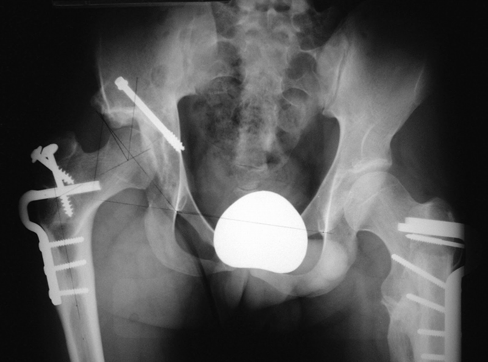 Healing, Empowering and Thriving: ABR redux....