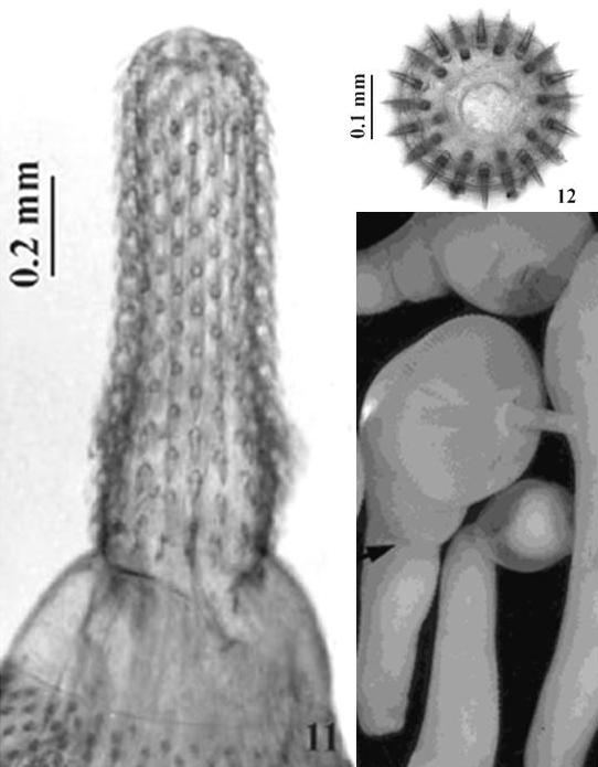 Parasite of the Day: Corynosoma cetaceum
