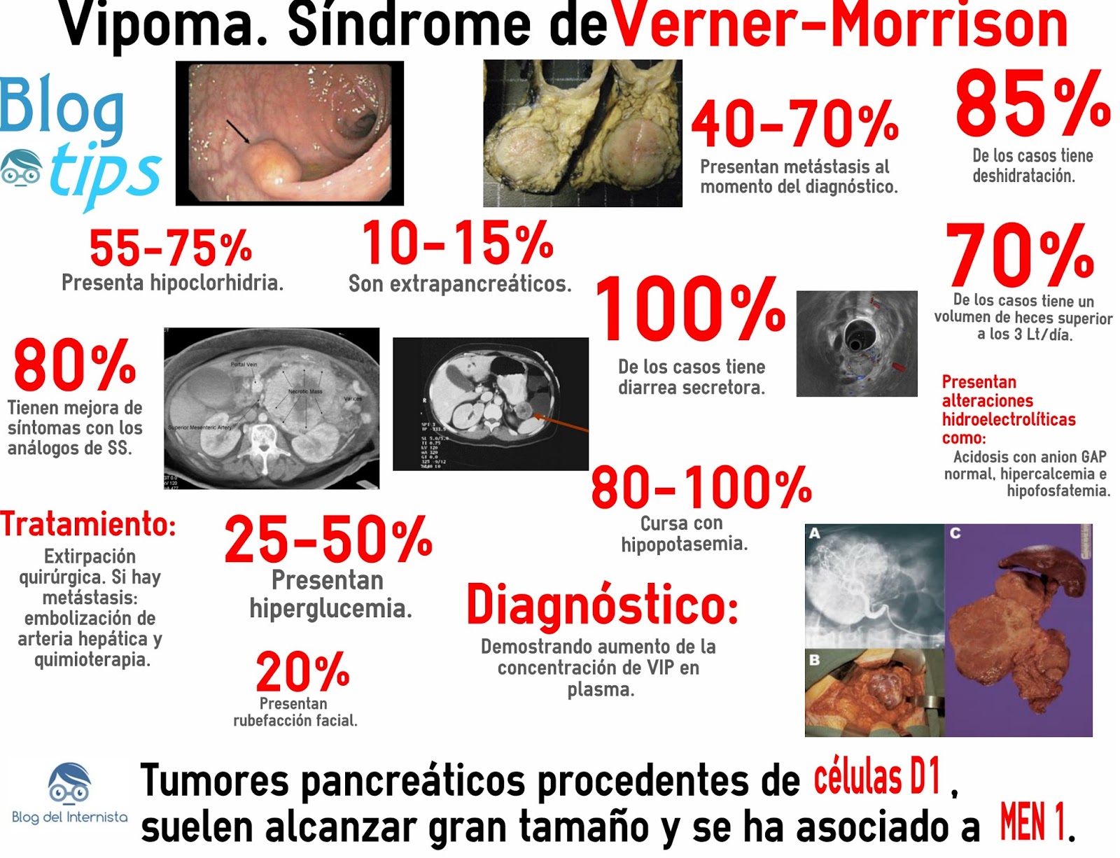 Blog del Internista: #BlogTips - Infographics