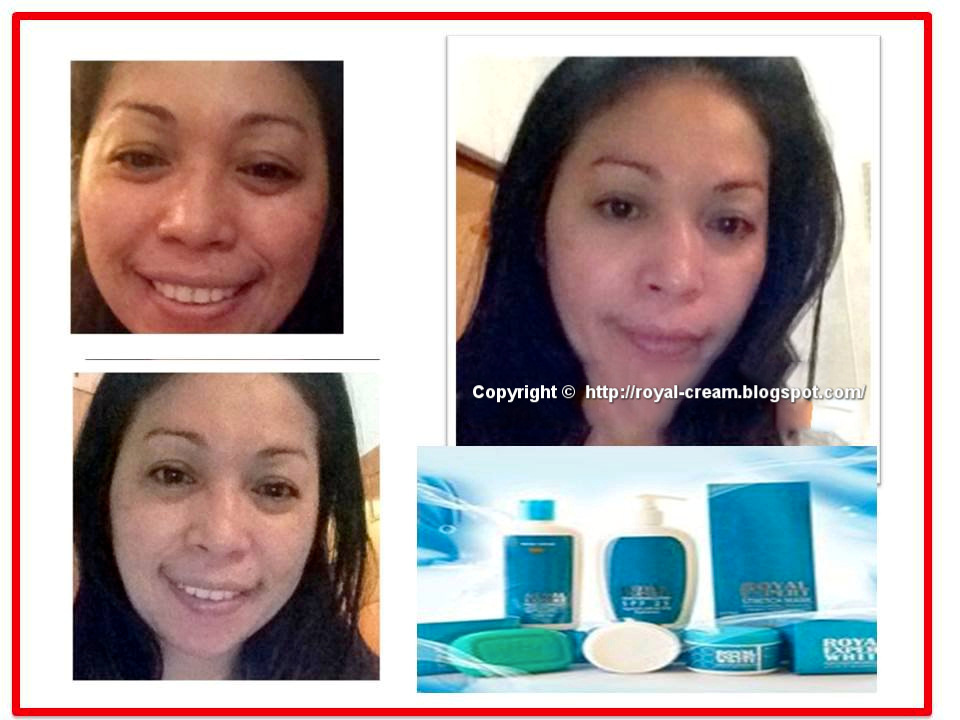 Royal Beauty Cream (Malaysia): Royal Expert White Cream Customer Feedback