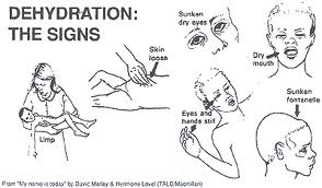 COCHIN CARDIAC CLUB: DEHYDRATION