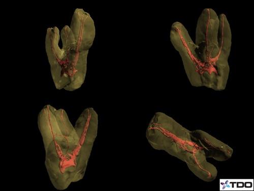 Root canal anatomy - Vertucci - Bauer Smiles
