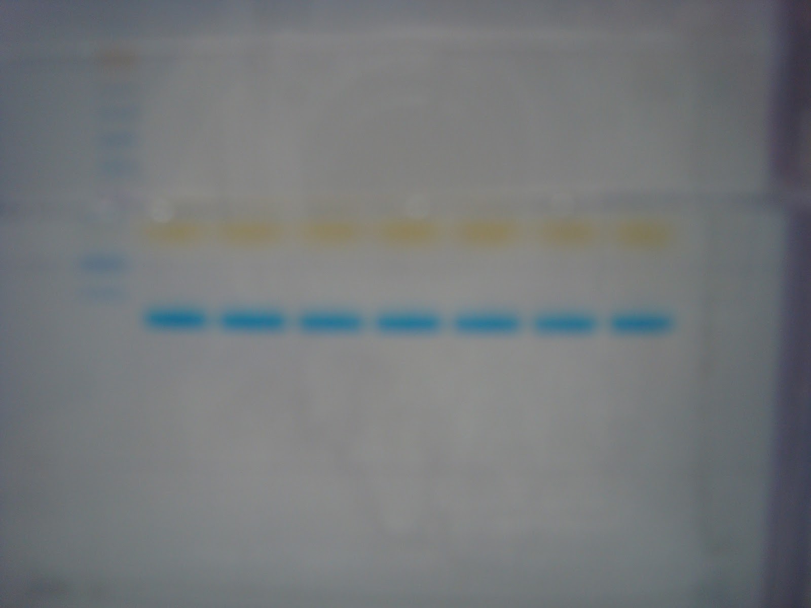 Let's Do Research!: Protein Gel Electrophoresis~Colloidal Blue Staining ...