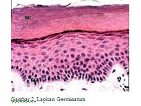 Dr Herry Setya Yudha Utama SpB. FInaCS. MHKes. ICS: KELAINAN PADA KULIT ...