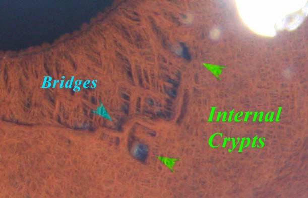 Modern & Multidimensional Iridology: Internal Crypt - Multidimensional ...