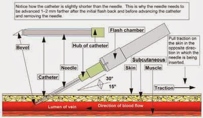 IV Insertion Guide ~ Nursing