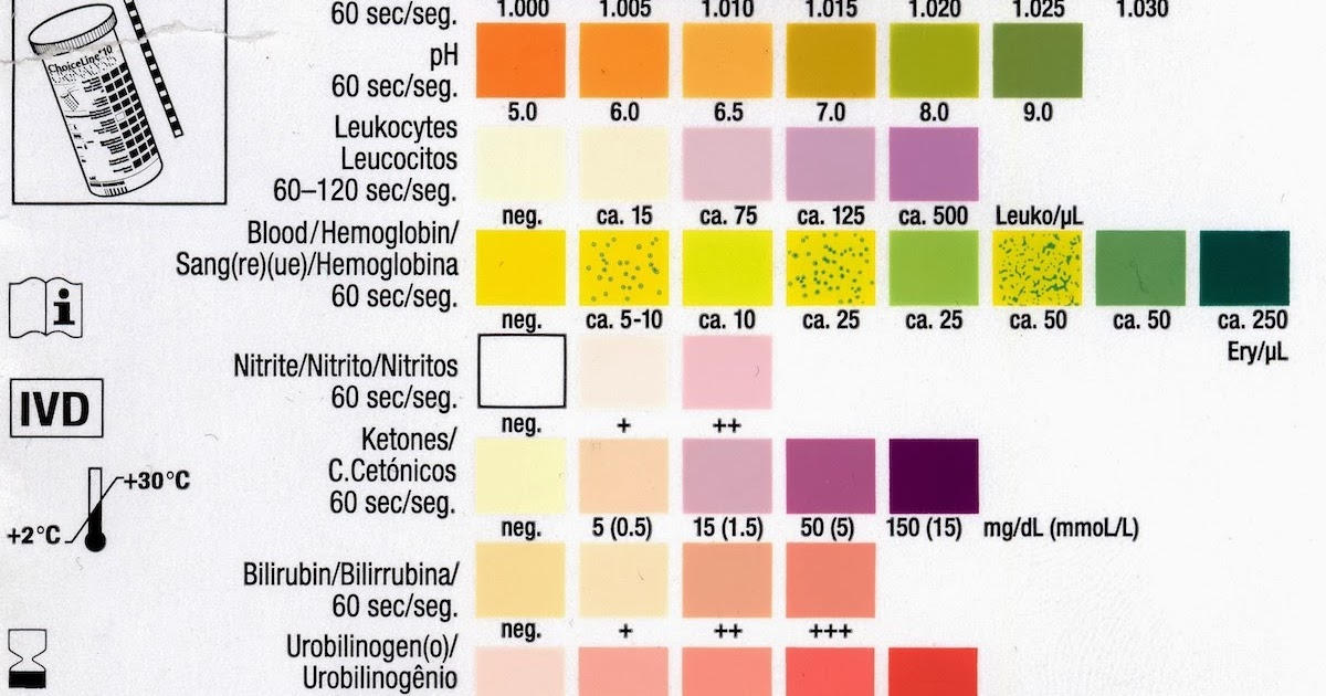 Pengertian Urinalisis | Analis Kesehatan