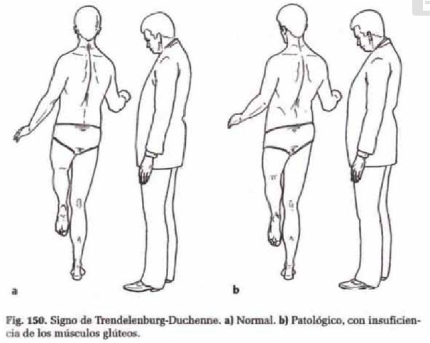MANIOBRA DE TRENDELEMBURG PDF