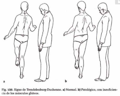 Teste De Schober Pdf - oceanfilecloud