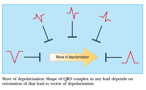 Simple Cardiology: - ECG (EKG) Paper.
