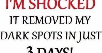 I’m SHOCKED It Removed My Dark Spots In 3 Days, Magic Remedy | HEALTH BLOG