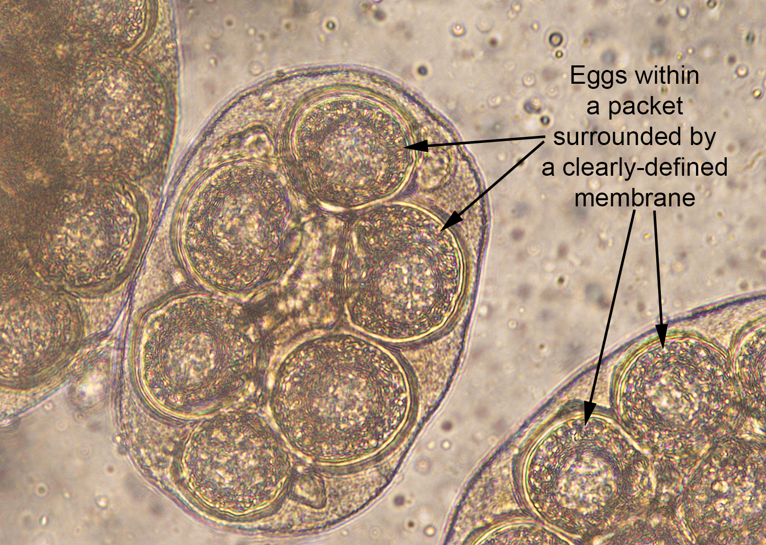 Creepy Dreadful Wonderful Parasites: Answer to Case 432