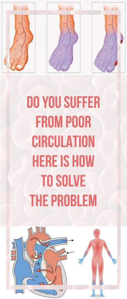 DO YOU SUFFER FROM POOR CIRCULATION? HERE’S HOW TO SOLVE THE PROBLEM ...