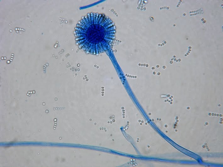 Fun With Microbiology (What's Buggin' You?): Syncephalastrum species