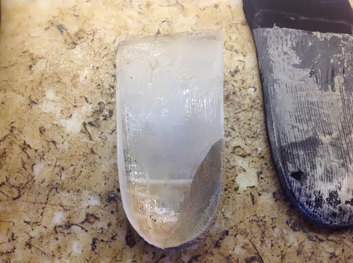 Foot and Ankle Problems By Dr. Richard Blake: Monday's Image of the ...