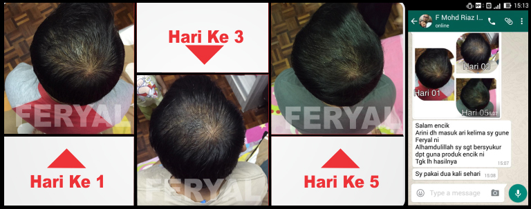 Produk Terbaik Melebatkan Rambut