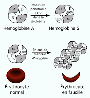 TPE Drépanocytose: La drépanocytose