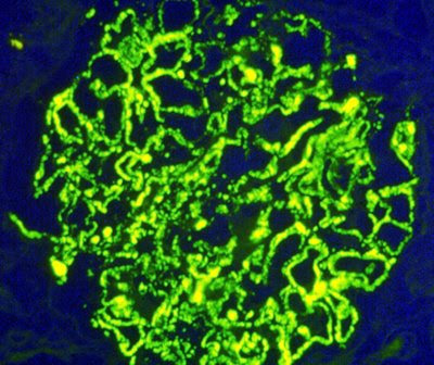 PATOLOGÍA: XIV. INMUNOFLUORESCENCIA