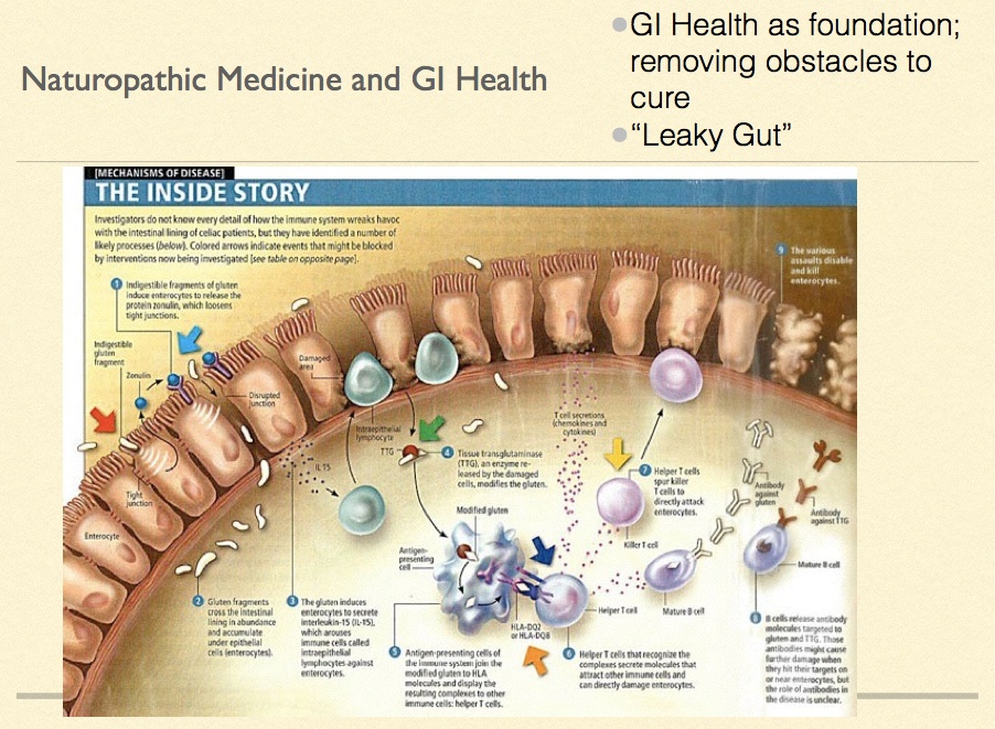 Systemic Candida: 2018