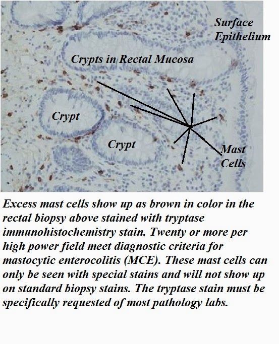 The Food and Gut Journal: What do mast cells look like under the ...