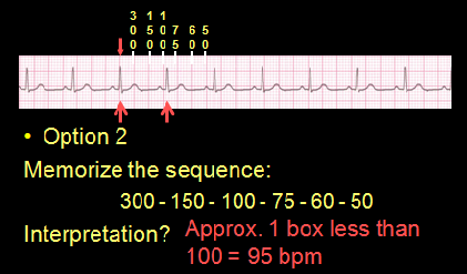 Dentistry and Medicine: ECG Rhythm Interpretation-How to Analyze a Rhythm