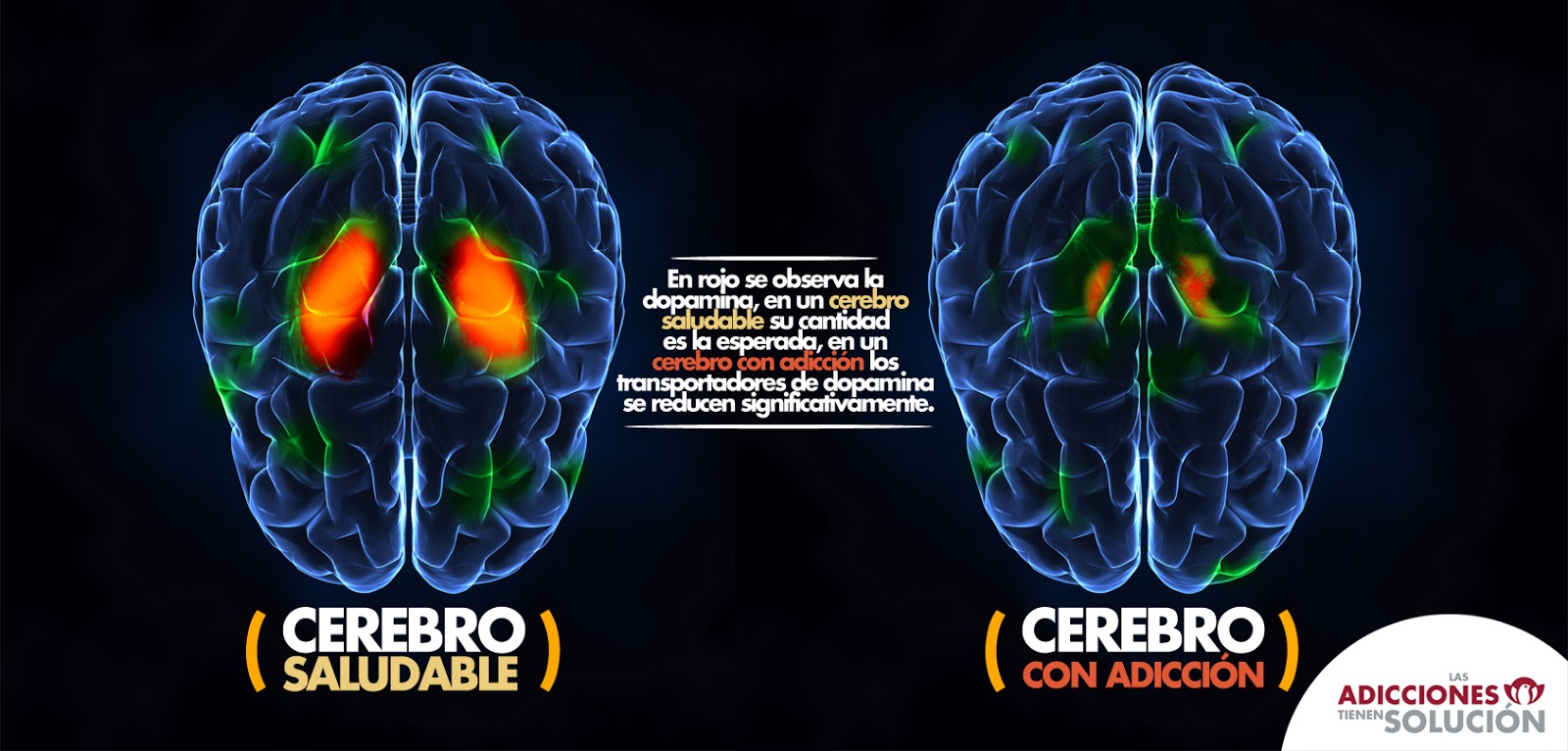 Como ser un estudiante en linea: Adicción y el Cerebro Humano