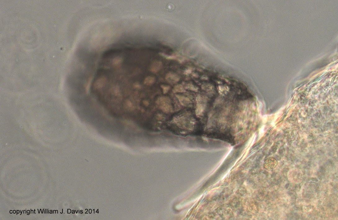 Wandering Naturalist: Protist Love 1--Difflugia!