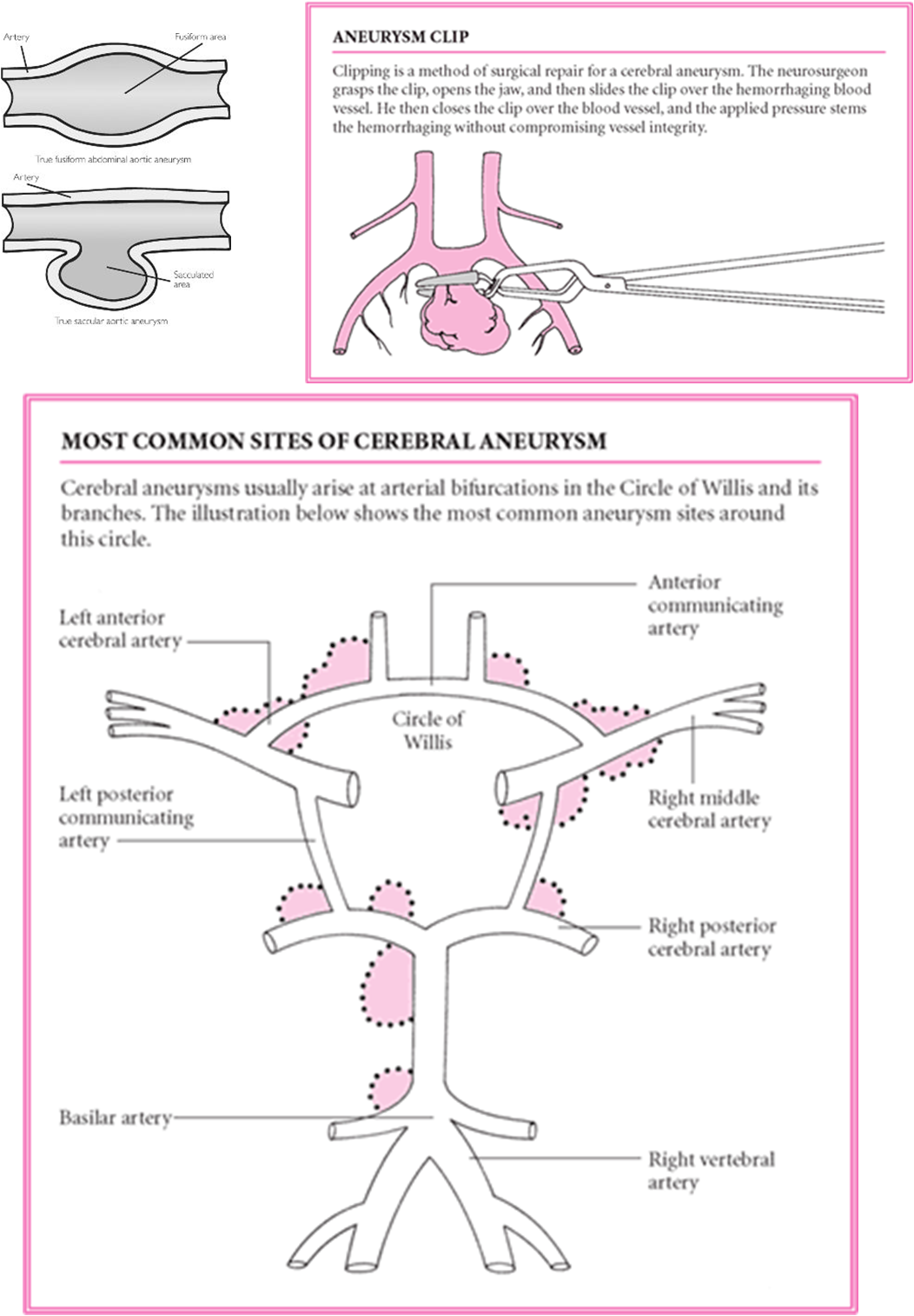 yuan's !nk: PART 1 brain varcularisation and ventricular system ...