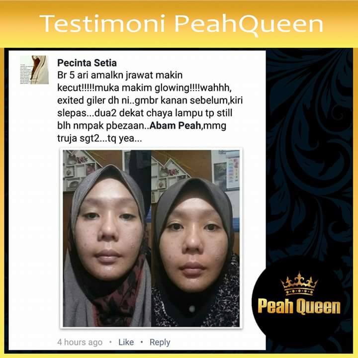 PEAH QUEEN SERBUK MUTIARA PERSIS KOREA - ISTIMEWA DAN TERBAIK UNTUK ANDA