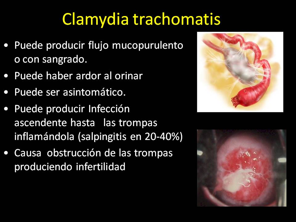 SALUD PARA LA MUJER Y EL HOMBRE: INFECCIONES VAGINALES QUE SON Y COMO ...