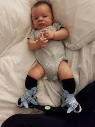 ::kalam nurani::: PERKONGSIAN TENTANG CTEV / CLUBFOOT / TALIPES