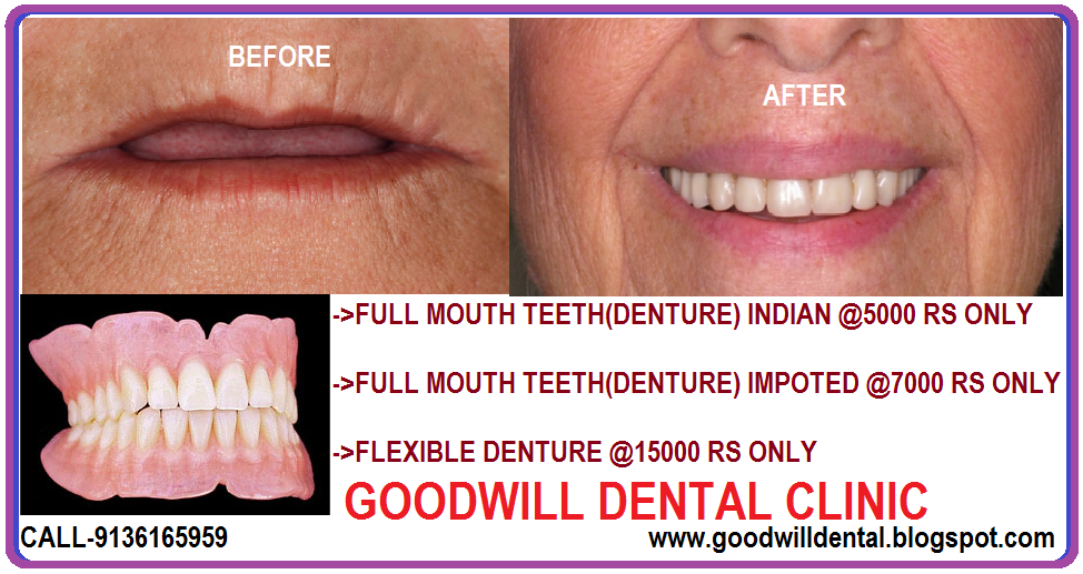 DENTAL CLINIC IN MOTI NAGAR, KIRTI NAGAR, SHADI PUR NEW DELHI: January 2013