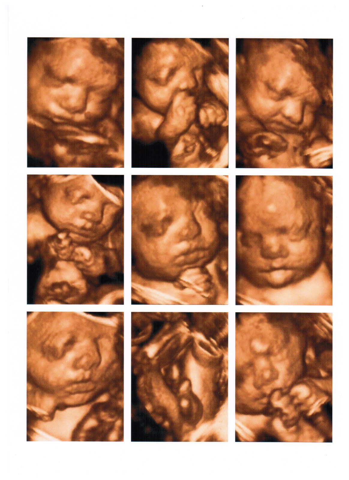 The Kearn Family Adventures Precious Previews 3D 4D Ultrasound The Kearn Family Adventures Precious Previews 3D 4D Ultrasound