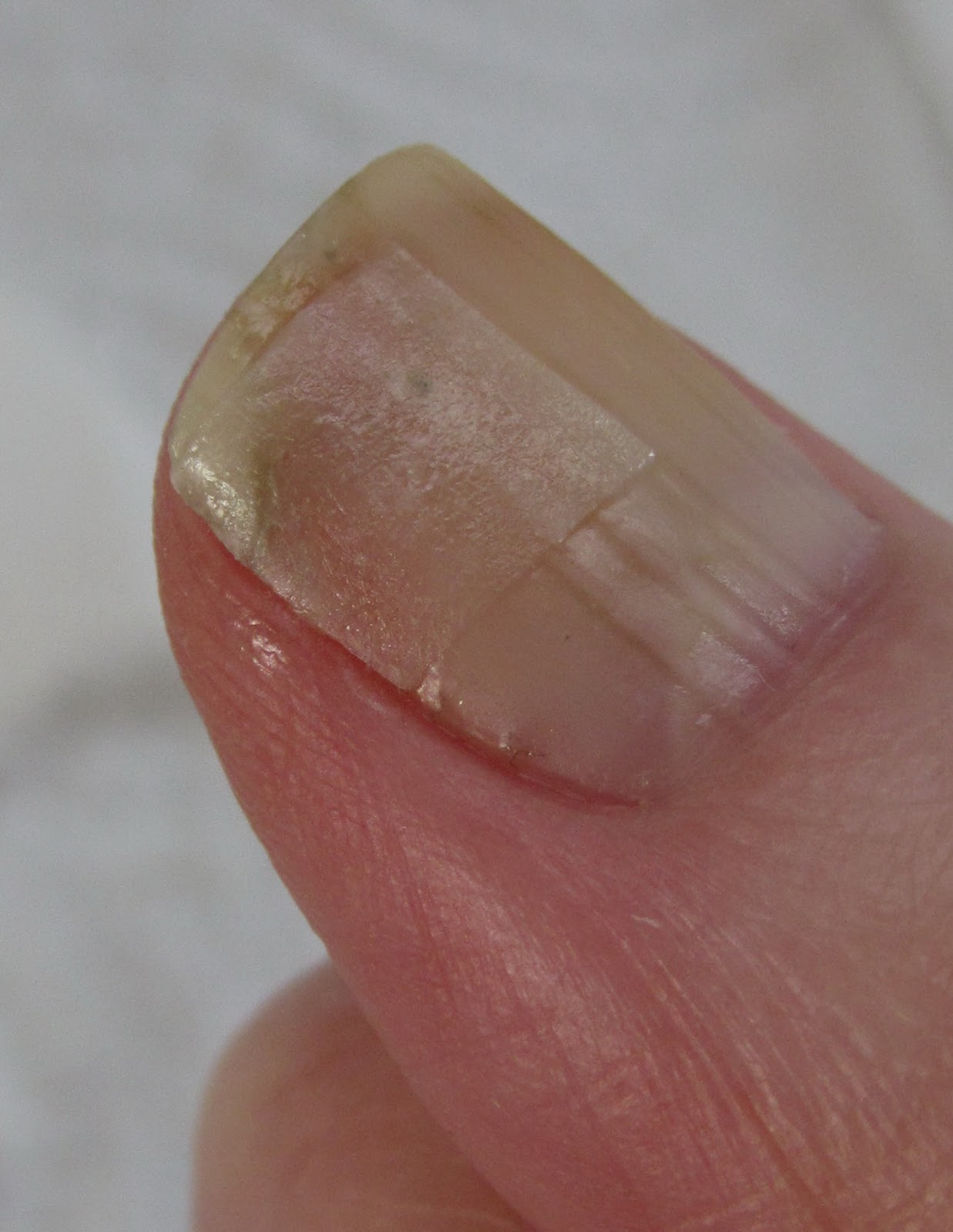 Marias Nail Art and Polish Blog: 1½ months of repairing a ripped/torn ...