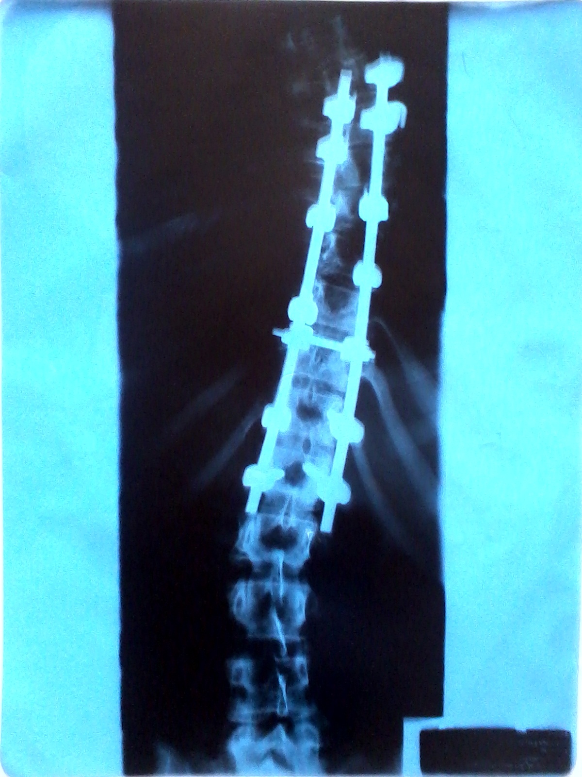 Crooked Spine: fevereiro 2012