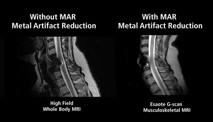 Dr Balaji Anvekar FRCR: MY PARENT INSTITUTE 3T MRI