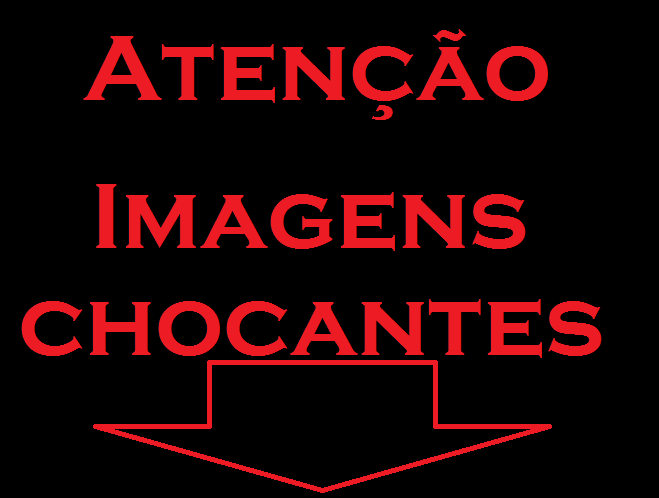 Conversa de Sogra: Marcos Kitano Matsunaga - Corpo