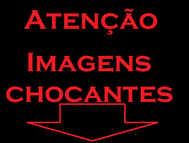 Conversa de Sogra: Marcos Kitano Matsunaga - Corpo