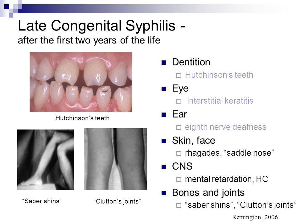 Hello USA: saber shins