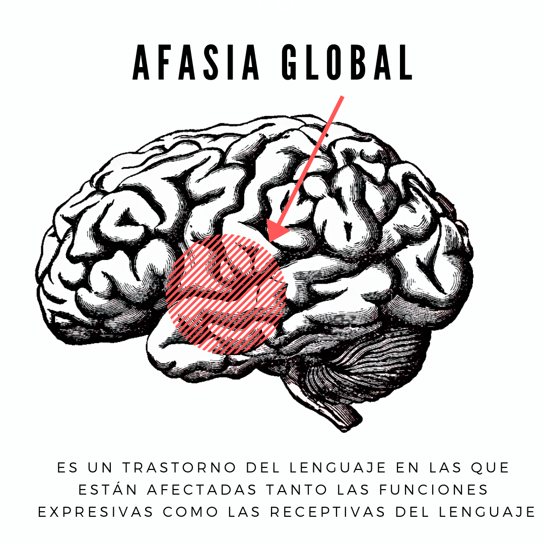 Trastornos del lenguaje (afasias) - Motivaciones Medicas