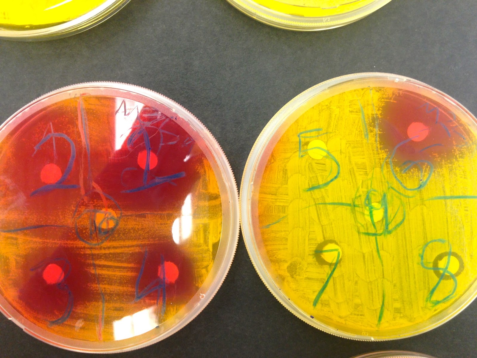 Microbiology Mania: Testing MRSA and other Pathogens {Labs 10 and 11 ...
