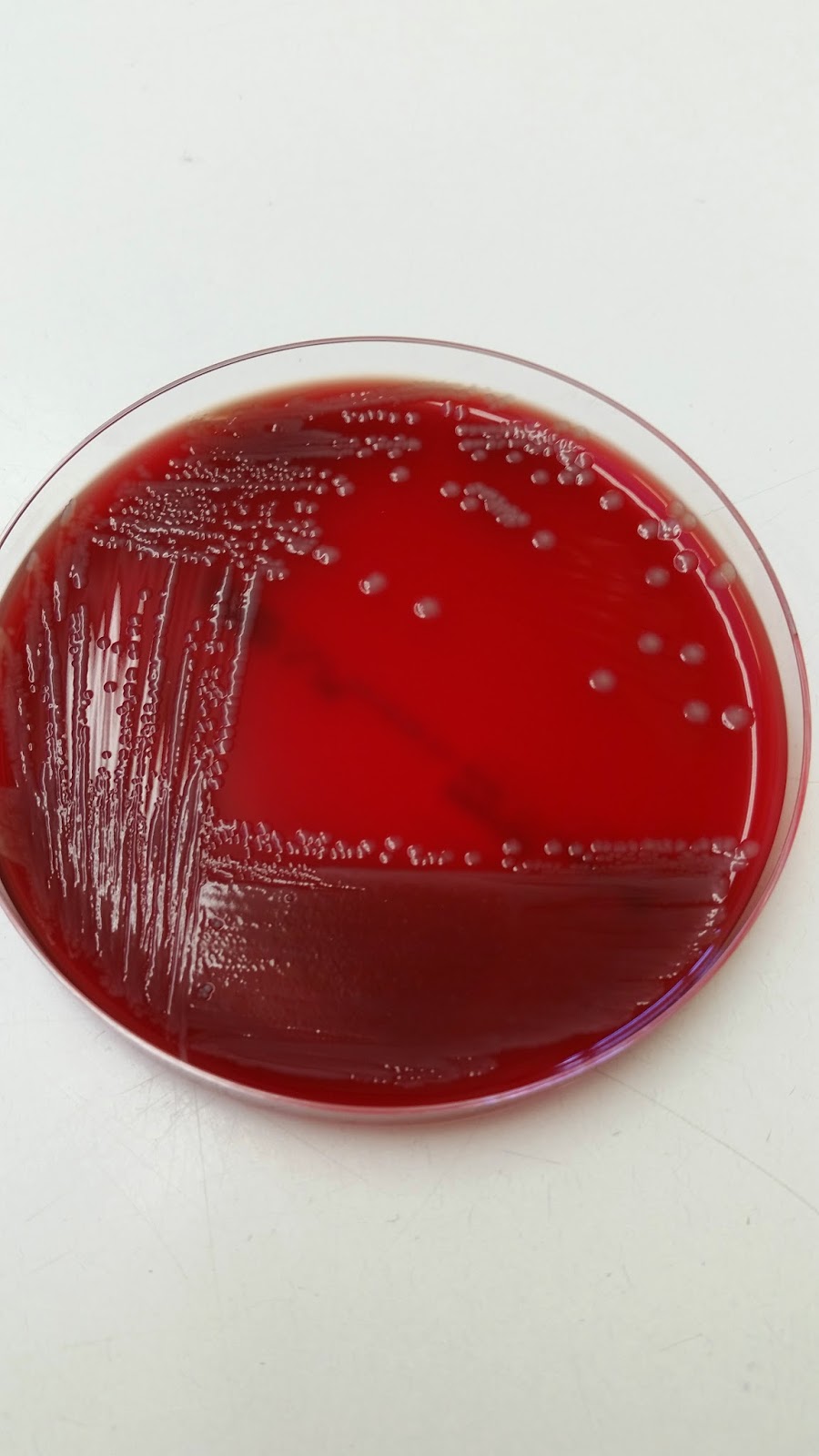 Microbiologylog: Salmonella spp. from Blood culture