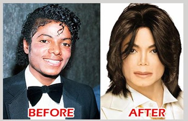 10 Most Famous and Best Examples of Worst Plastic Surgery - Daily News