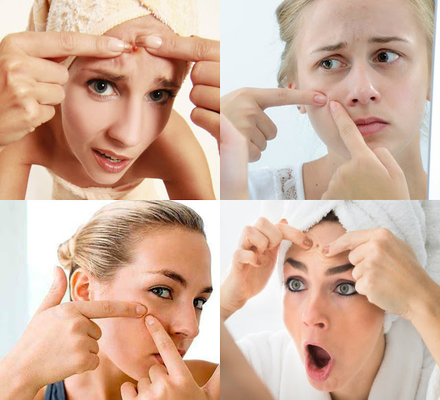 Curar el Acne Desde Adentro en 3 Dias de Forma Natural - SALUD TOTAL TIPS