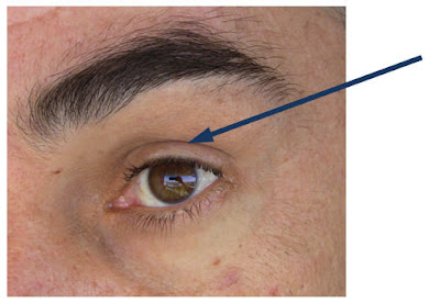 Sharma Facial Plastic Surgery Blog