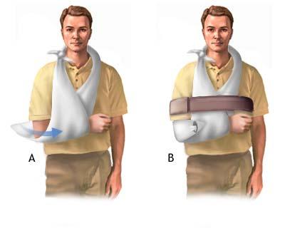 Vendajes e inmovilización: PRIMEROS AUXILIOS (Vendaje y inmovilización)